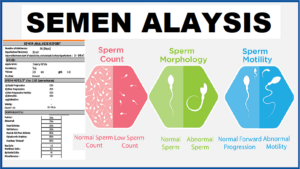 How To Read A Sperm Analysis Report? - Aarush IVF & Endoscopy Centre